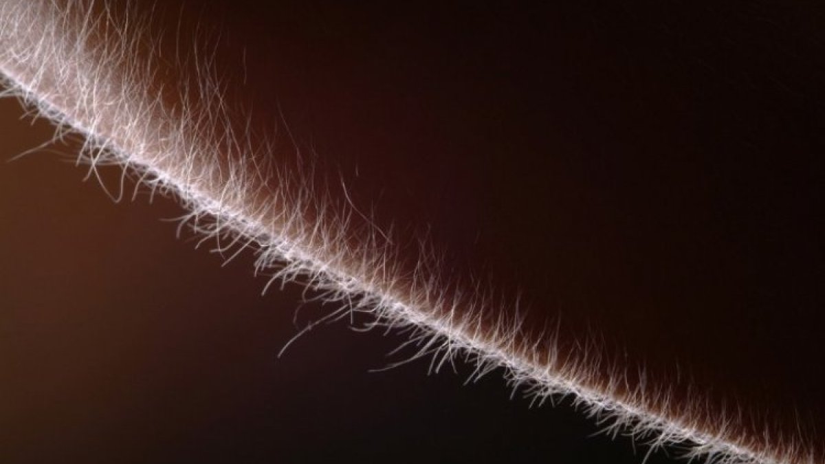 Why We Get Goosebumps: The Science Behind It - Hidabroot
