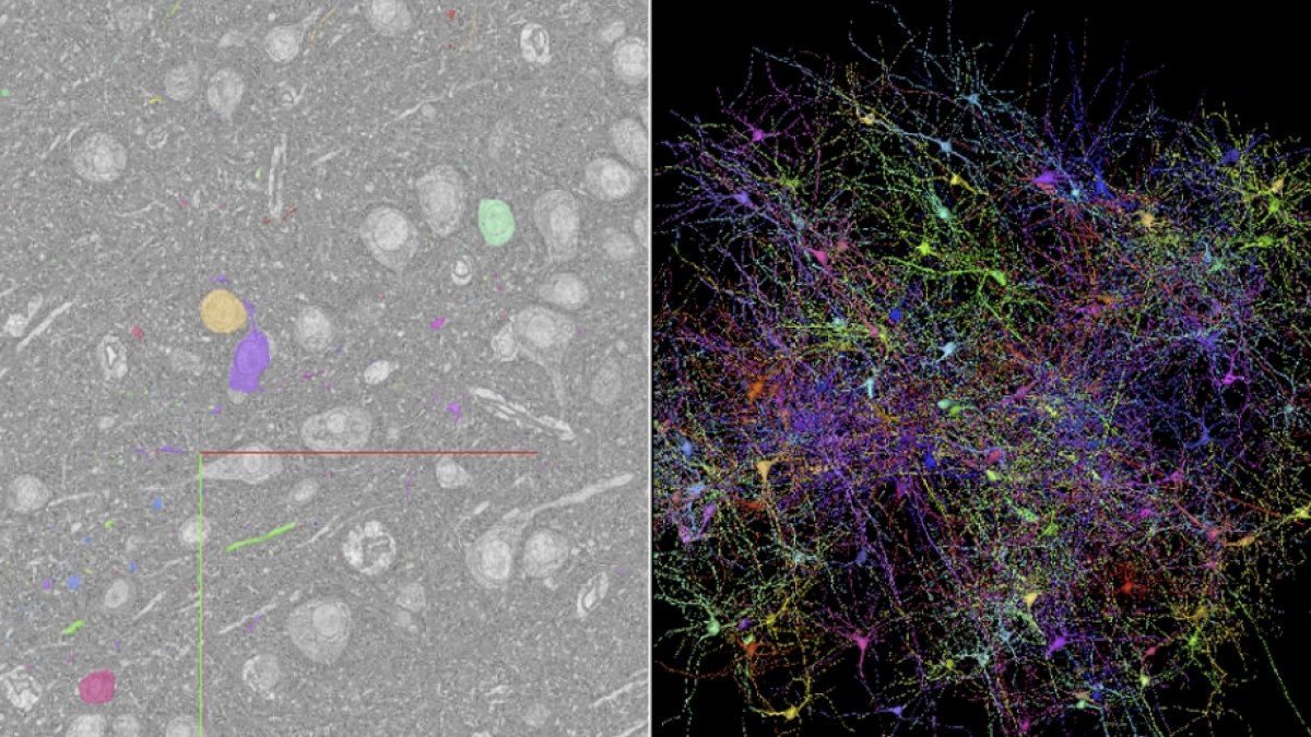 Decoding the Human Brain: Google's Groundbreaking Mapping Project ...